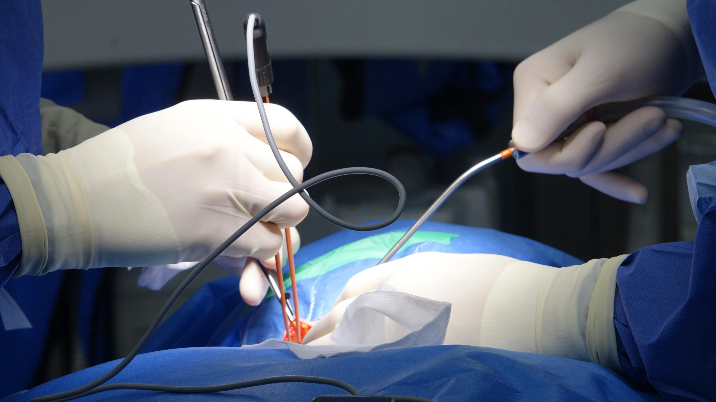 The Future of Complex General Surgery - Northwestern Surgical Associates